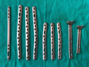 Forearm Plates – Ortho Providers